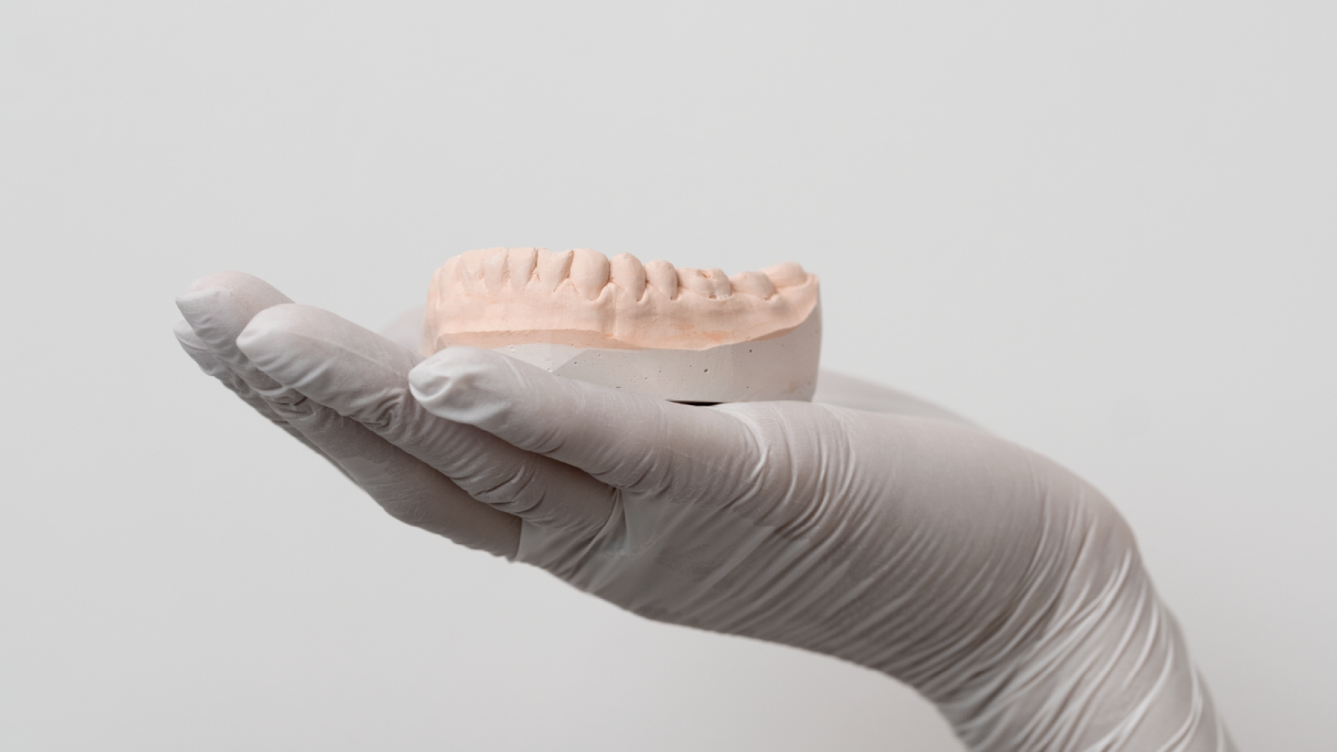 WAX UP Technology in Dentistry: Preliminary Modeling for the Perfect Smile
