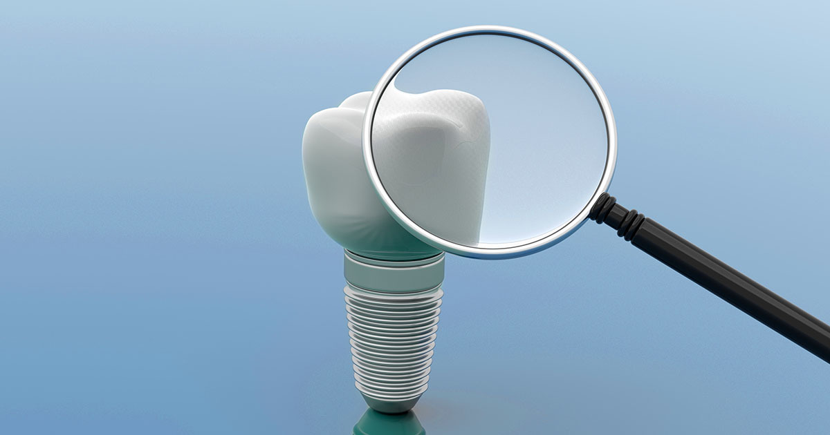 Why is dental implants an non-alternative treatment method for adentia?